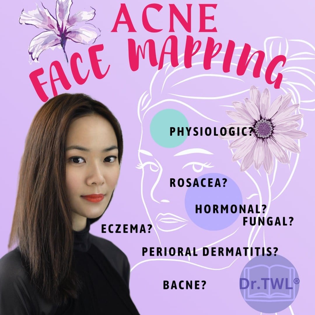 Complete Acne Guide | Dr.TWL | Dermatologist Formulated Skincare in ...