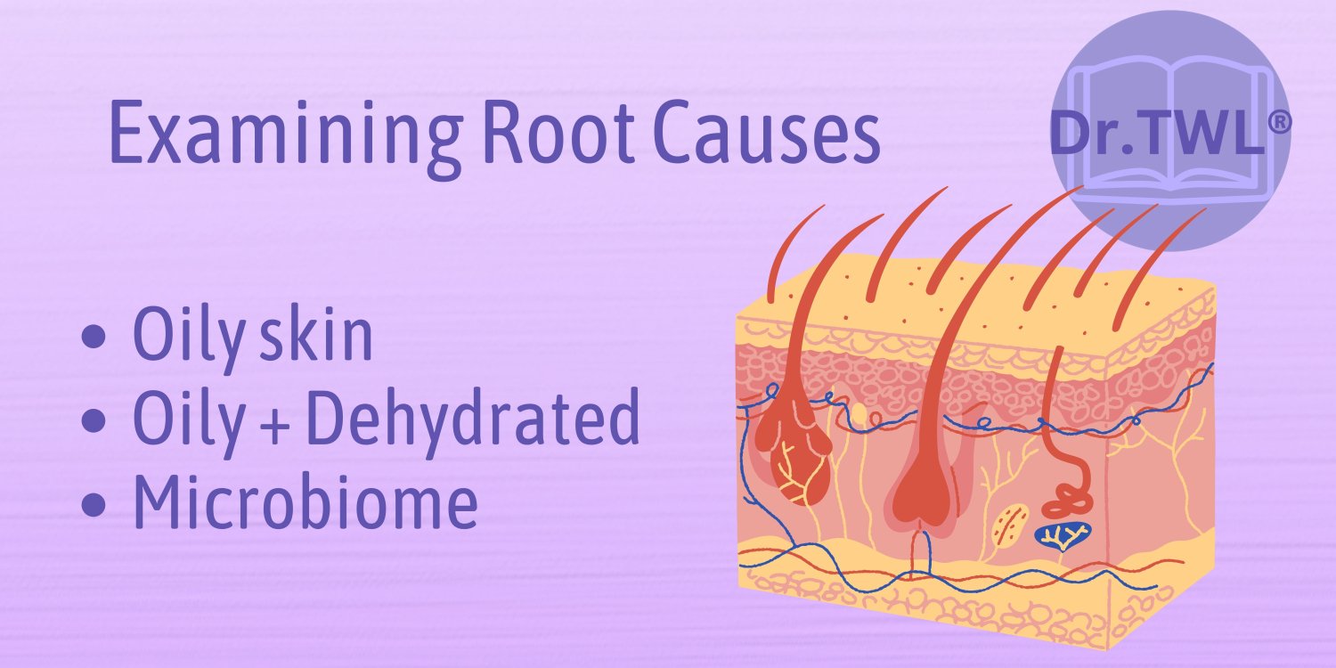 Complete Acne Guide | Dr.TWL | Dermatologist Formulated Skincare in ...